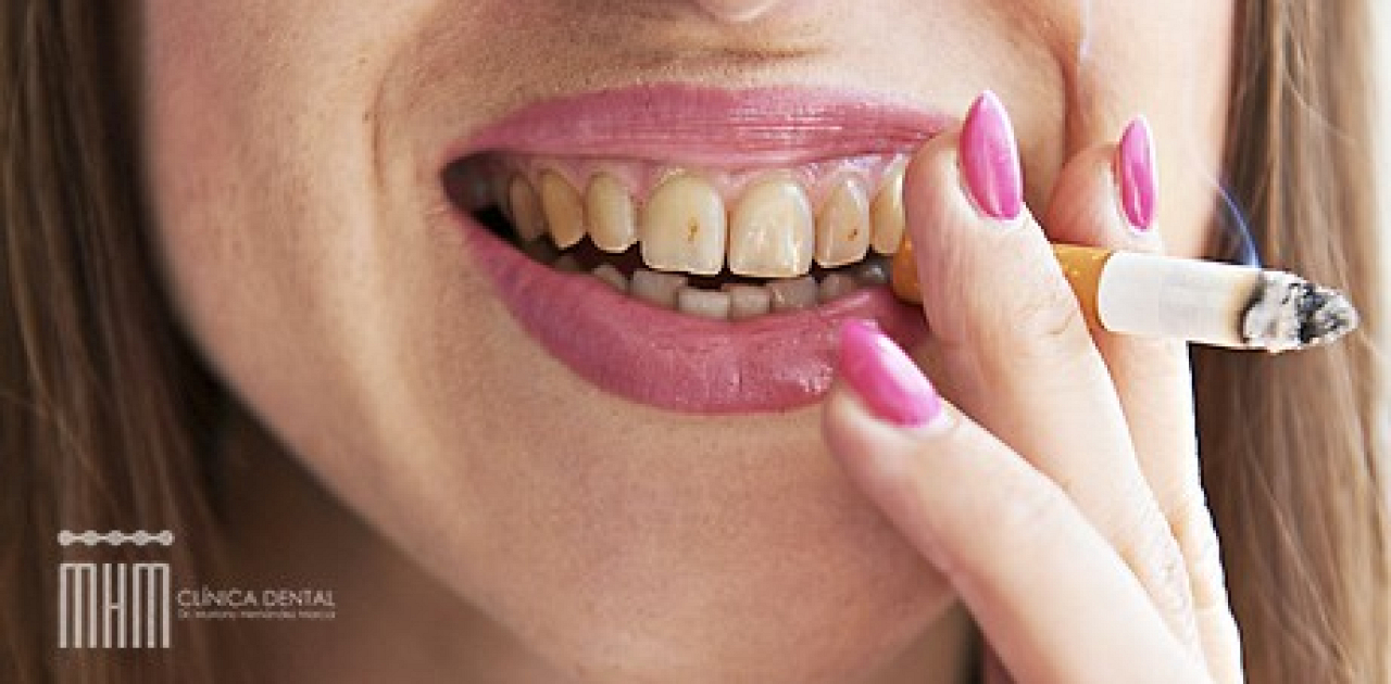 El tabaco y la salud dental. Conoce todos sus efectos en la boca ...